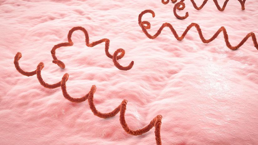 Che cos'è la sifilide - Paginemediche