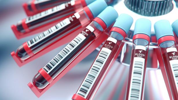 Emocromo, che cos'è? - Paginemediche